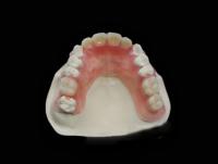 China Custom Made Nonporous Valplast Flexible Partial Denture Biocompatible Nylon Resin for sale