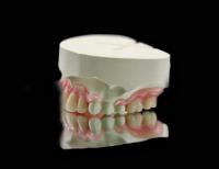 China Translucent Pink Valplast Denture Flexible Partial Biocompatible Nylon Resin for sale