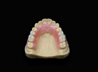 China Biocompatible Nylon Resin Valplast Flexible Partial Denture Metal Free 1.5mm Thickness for sale