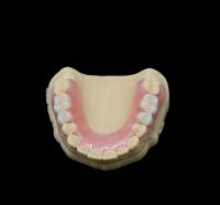 China Biocompatible Nylon Resin Valplast Flexible Partial Denture Metal Free 1.5mm Thickness for sale