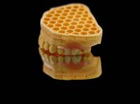 China Removable Valplast Partial Denture High Flexibility Biocompatible Nylon Resin Metal-Free Dental Lab for sale
