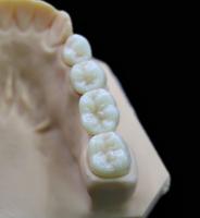 China Full Contour Zirconia Dental Zircon Block 98mm High Translucency for CAD CAM Milling for sale