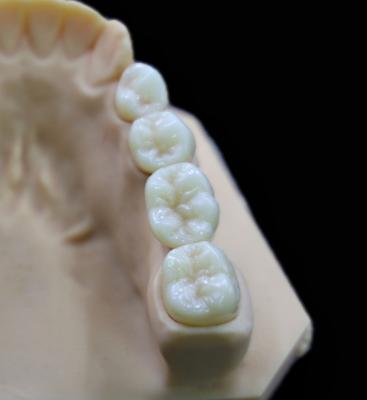 China Full Contour Zirconia Dental Zircon Block 98mm High Translucency for CAD CAM Milling for sale