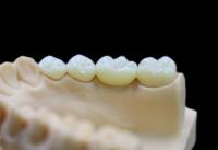 China CAM Milling Dental Zirconia Block 98mm High Translucency 800-1200 MPa Strength Metal Free Crown for sale