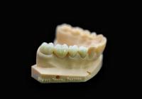 China CAM Milling Dental Zirconia Block 98mm High Translucency 800-1200 MPa Strength Metal Free Crown for sale