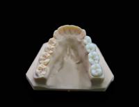 China Zirconia Dental Crown CAD CAM Milling 1200 MPa High Strength Full Contour Zirconium Dioxide for sale