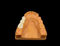 China CAD CAM Dental Zirconia Full Contour Crown 1200 MPa High Strength Metal-Free for sale