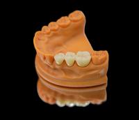 China Dental Zirconia Crown CAD CAM Milling 1200 MPa Flexural Strength Full Contour Zirconia for sale