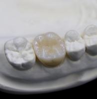 China Zirconia Dental Lab High Flexural Strength 1200 MPa Full Zirconia Crown CAD CAM Milling for sale