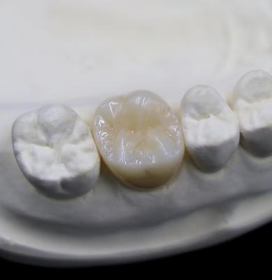 China Zirconia Dental Lab High Flexural Strength 1200 MPa Full Zirconia Crown CAD CAM Milling for sale