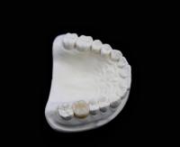 China Zirconia Dental Lab High Flexural Strength 1200 MPa Full Zirconia Crown CAD CAM Milling for sale
