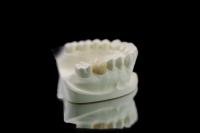 China Hypoallergenic Dental Zirconia Crown CAD CAM Milling 1200 MPa Flexural Strength for sale