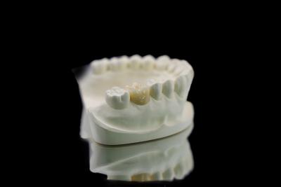 China Hypoallergenic Dental Zirconia Crown CAD CAM Milling 1200 MPa Flexural Strength for sale