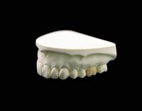 China Hypoallergenic Dental Zirconia Crown CAD CAM Milling 1200 MPa Flexural Strength for sale