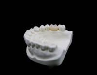 China Zirconia Dental Lab Outsourcing CAD/CAM Milling Metal Free Crown 800-1200 MPa for sale