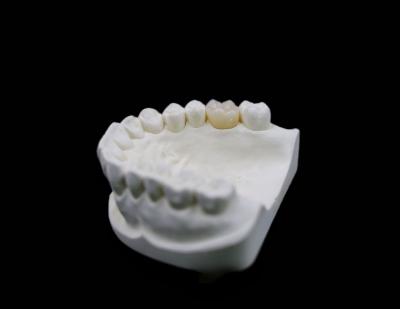 China Zirconia Dental Lab Outsourcing CAD/CAM Milling Metal Free Crown 800-1200 MPa for sale