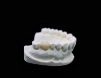 China Zirconia Dental Lab Outsourcing CAD/CAM Milling Metal Free Crown 800-1200 MPa for sale
