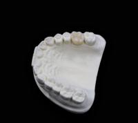 China CAD CAM Dental Zirconia Crowns Full Contour 800-1200 MPa Metal-Free Dental Lab for sale
