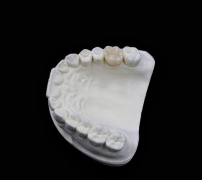 China CAD CAM Dental Zirconia Crowns Full Contour 800-1200 MPa Metal-Free Dental Lab for sale