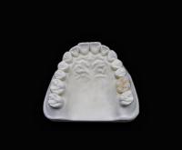 China CAD CAM Dental Zirconia Crowns Full Contour 800-1200 MPa Metal-Free Dental Lab for sale