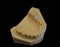 China Translucent Dental Zircon Block High Bond Strength 98mm for CAD CAM Milling for sale