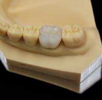China Dental Lab Zirconia Veneering Porcelain Full VITA Shade Compatibility 10.5 CTE for sale