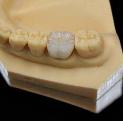 China Dental Lab Zirconia Veneering Porcelain Full VITA Shade Compatibility 10.5 CTE for sale