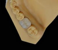 China Zircon Translucent Veneering Porcelain for Zirconia VITA Classical A1-D4 Dental Lab for sale
