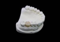 China Glossy Surface Dental Zircon Veneering Porcelain 98mm Low Fusing Ceramic for Zirconia Restorations for sale