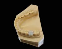 China Glossy Surface Dental Zircon Veneering Porcelain 98mm Low Fusing Ceramic for Zirconia Restorations for sale