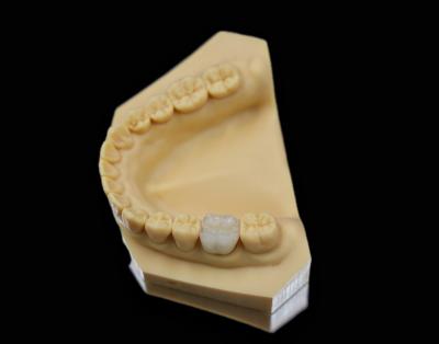 China Glossy Surface Dental Zircon Veneering Porcelain 98mm Low Fusing Ceramic for Zirconia Restorations for sale
