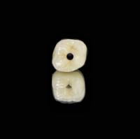 China Dental Implant System Pure Titanium Tapered Body 4mm Diameter for Prosthodontics for sale