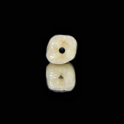 China Dental Implant System Pure Titanium Tapered Body 4mm Diameter for Prosthodontics for sale