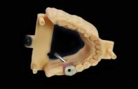 China Commercially Pure Titanium Dental Implant System Tapered Body Internal Connection 4.0mm for sale