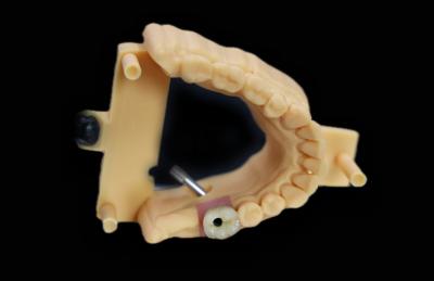 China Commercially Pure Titanium Dental Implant System Tapered Body Internal Connection 4.0mm for sale