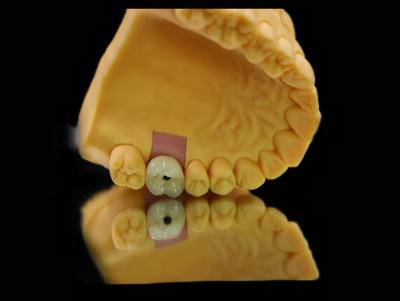 China Tapered Cylindrical Hybrid Dental Implant System Internal Connection CP Titanium 4.0mm for sale