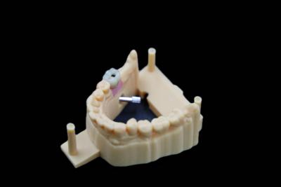 China 3.75mm-4.5mm Titanium Dental Implant CPTi Internal Connection for Prosthodontics for sale