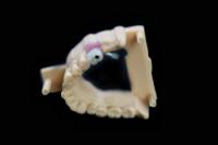 China 3.75mm-4.5mm Titanium Dental Implant CPTi Internal Connection for Prosthodontics for sale