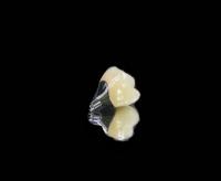 China CPTi Ti-6Al-4V Dental Implant System 4.1mm x 10mm Internal Connection for Prosthodontics for sale