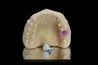 China Titanium Dental Implant System Screw Retained Internal Connection for Prosthodontics for sale