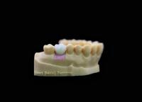 China Cement Retained Dental Implant System CPTi Internal Connection Tapered Body 4.1mm for sale