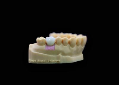 China Cement Retained Dental Implant System CPTi Internal Connection Tapered Body 4.1mm for sale