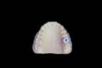 China Cement Retained Dental Implant System CPTi Internal Connection Tapered Body 4.1mm for sale