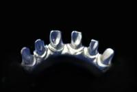 China Titanium Dental Implant System 3.75mm-4.5mm Diameter Screw Retained Internal Connection for sale