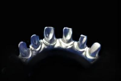 China Titanium Dental Implant System 3.75mm-4.5mm Diameter Screw Retained Internal Connection for sale