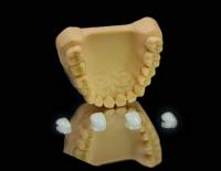 China China Dental Lab Porcelain Veneers 0.3mm Ultra Thin Stain Resistance Minimally Invasive for sale