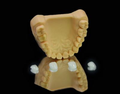 China China Dental Lab Porcelain Veneers 0.3mm Ultra Thin Stain Resistance Minimally Invasive for sale
