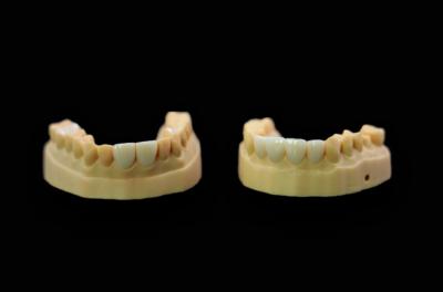 China Custom Anatomical Dental Veneers Porcelain 0.3mm China Dental Outsourcing for sale