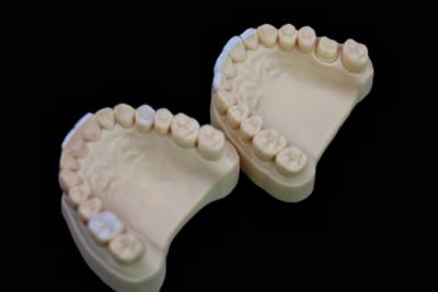 China Custom Dental Veneers Porcelain 0.3mm Ultra Thin Minimally Invasive Ceramic Veneer for sale