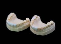 China Custom Dental Veneers Porcelain 0.3mm Ultra Thin Minimally Invasive Ceramic Veneer for sale